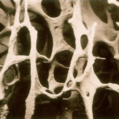 maintain_bone_density | Keep Healthy