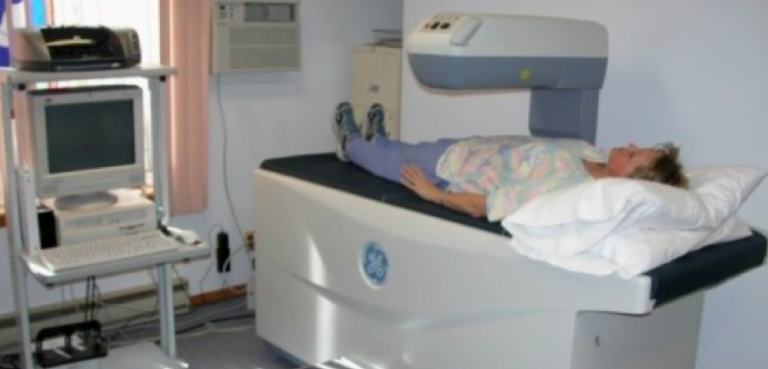 Why and how to measure bone density. Who should have a dexa scan